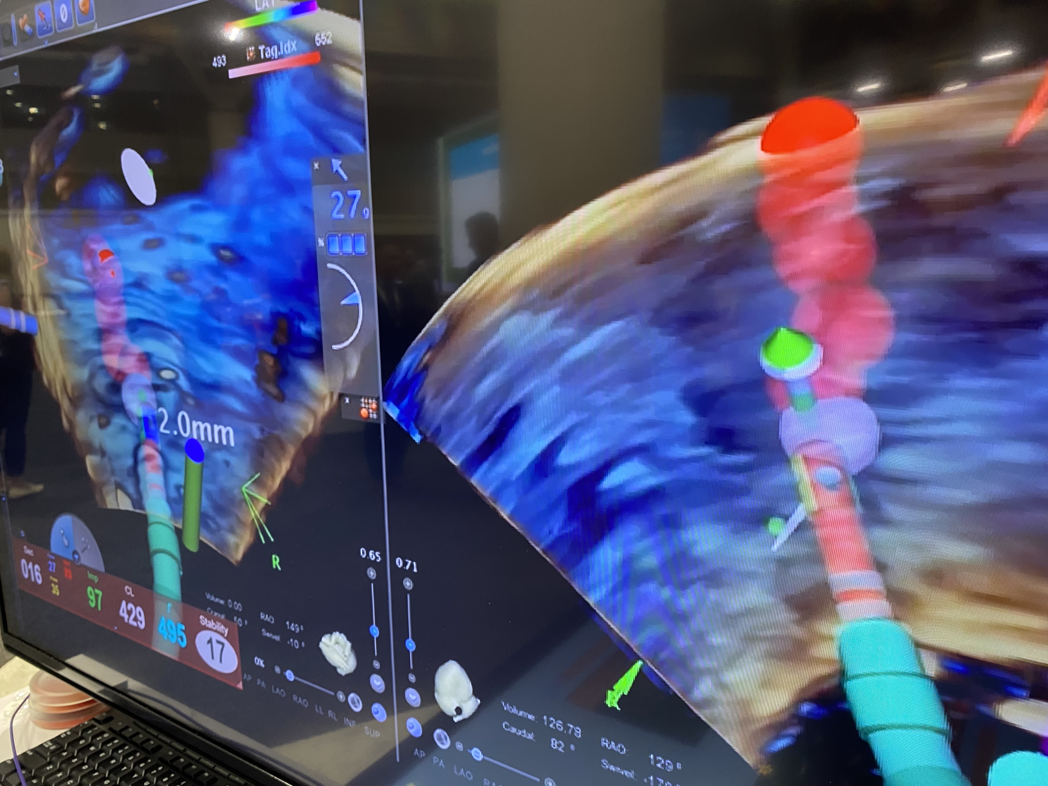 PHOTO GALLERY: Electrophysiology advances at Heart Rhythm 2023