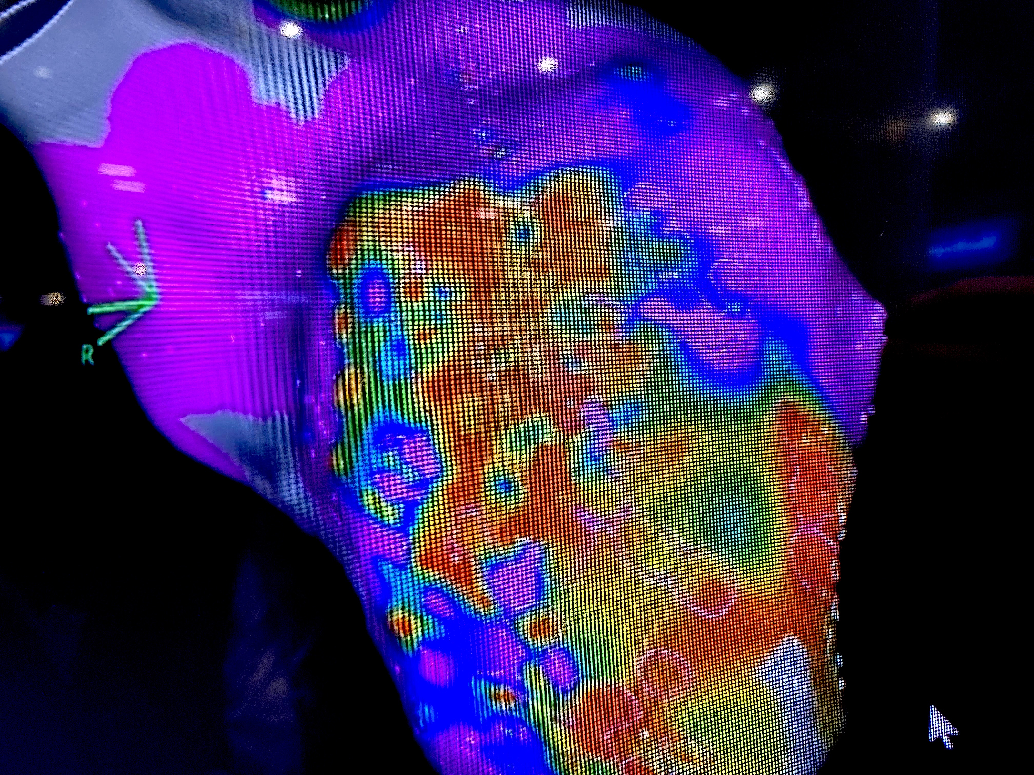 PHOTO GALLERY: Electrophysiology advances at Heart Rhythm 2023