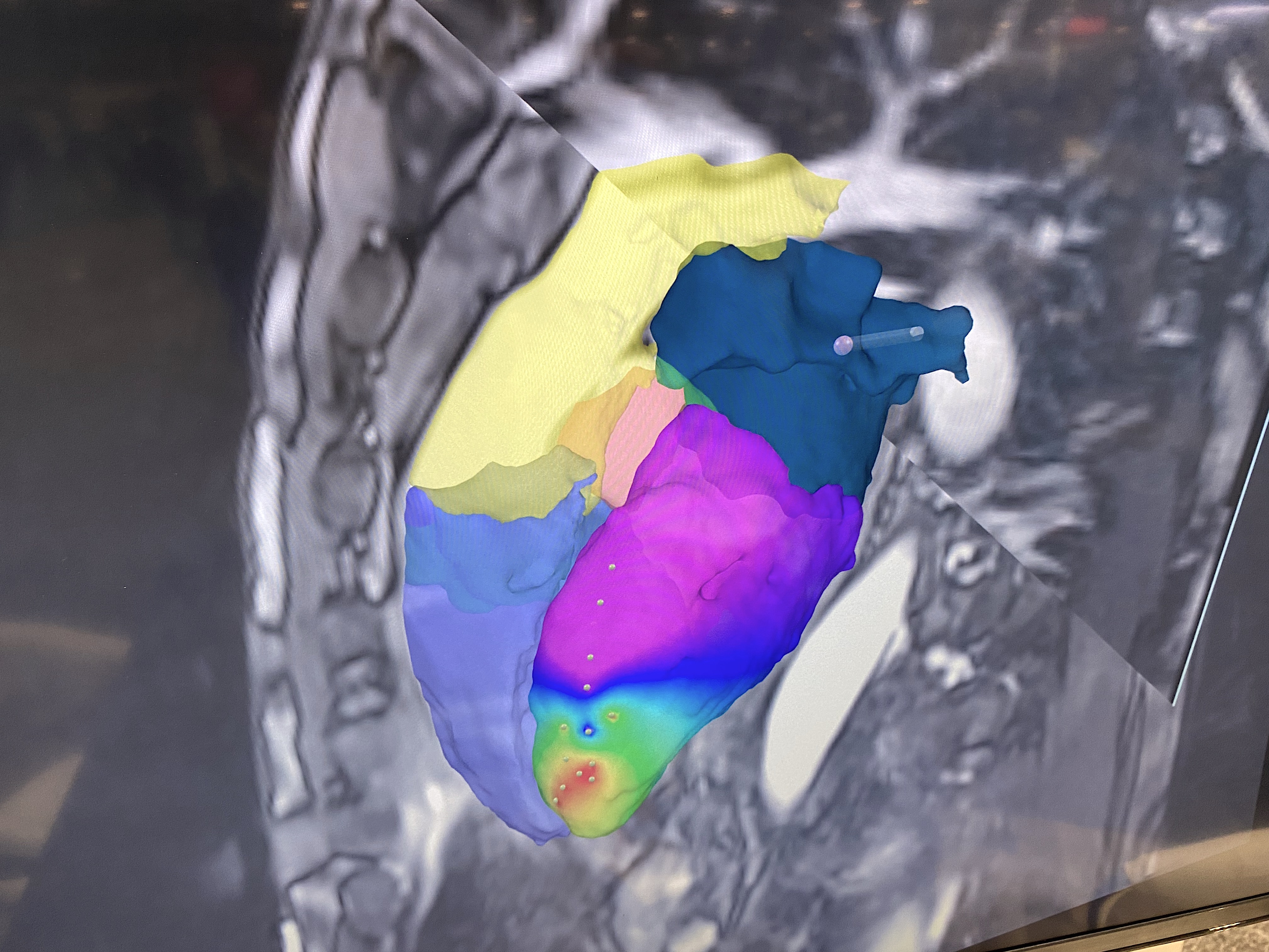 PHOTO GALLERY: Electrophysiology advances at Heart Rhythm 2023