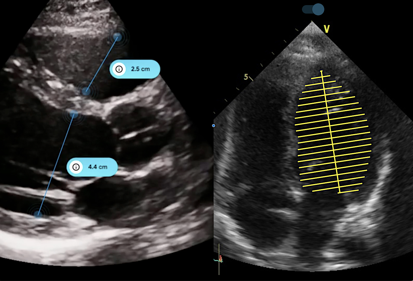 Icardio Identifying Functional Metabolic Shifts In Heart Failure With