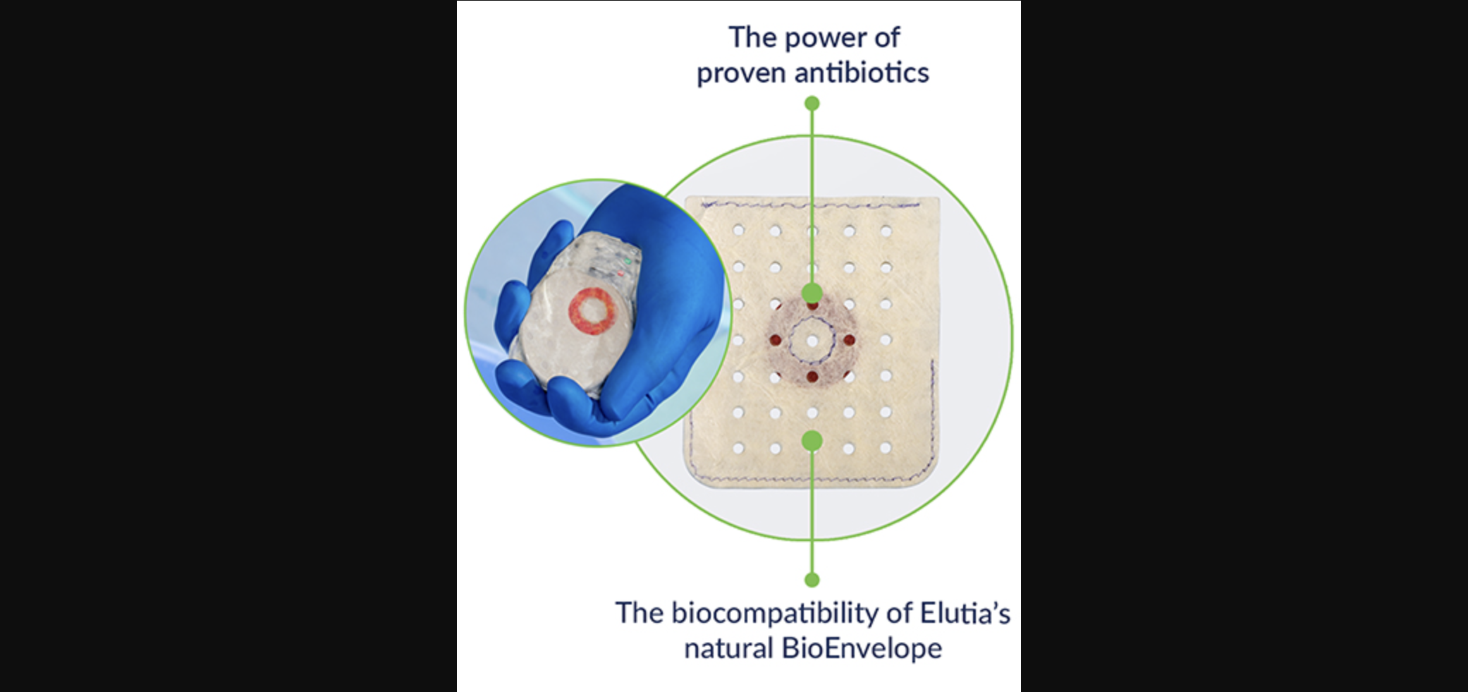 Boston Scientific to purchase Elutia’s drug-eluting envelope business ...