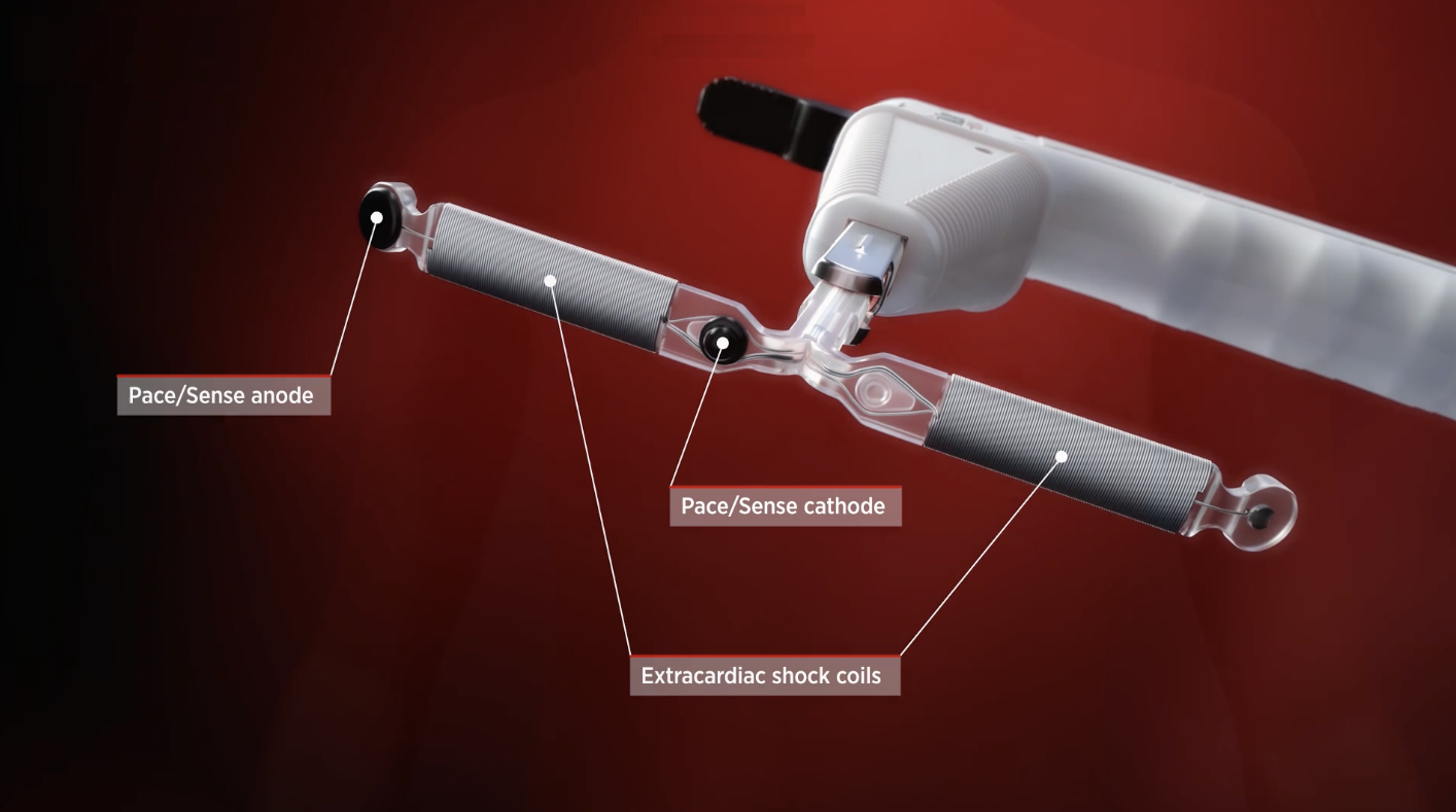 Abbott works with AtaCor Medical on extravascular ICD system