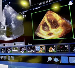 American Society of Echocardiography (ASE) | Cardiovascular Business