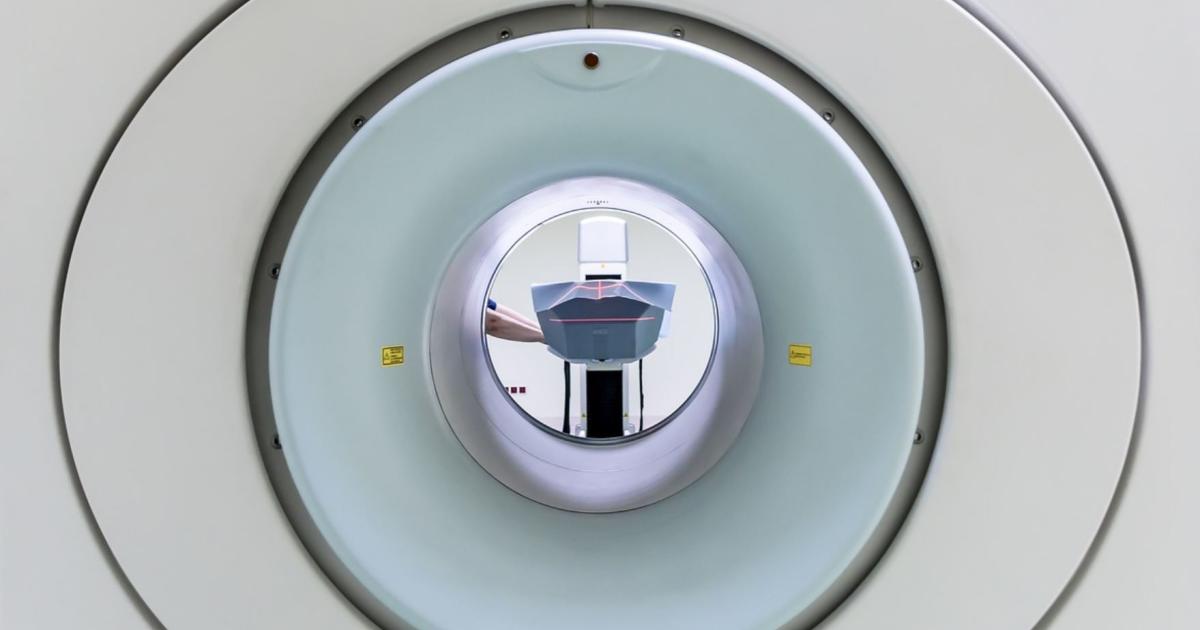 Medtronic, Viz.ai partner to improve LVO stroke detection