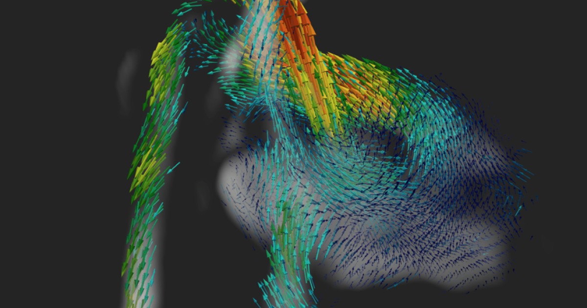 New 4D imaging technique seen as a 'massive leap forward’ in fetal ...