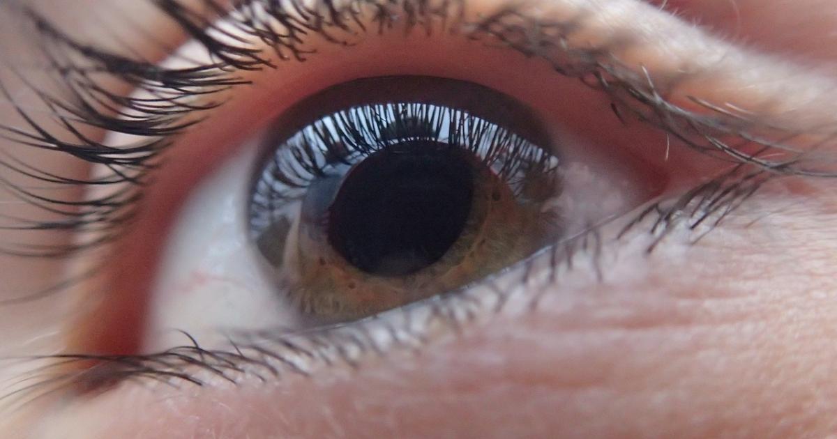 AI uncovers ‘vascular fingerprints’ in the eye that can predict strokes