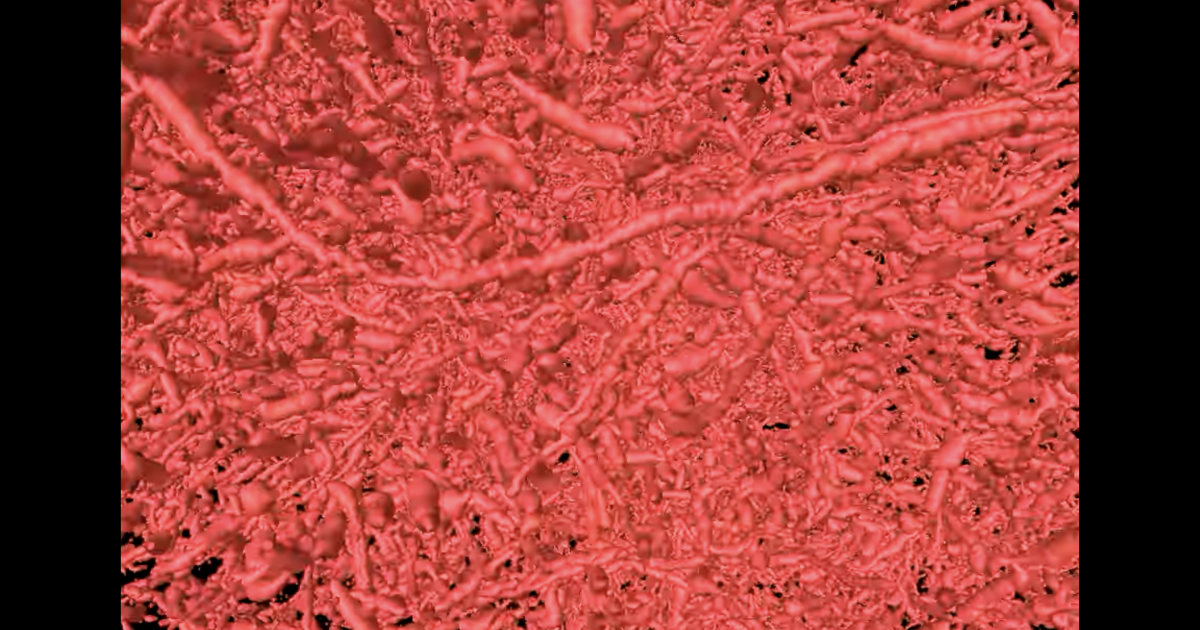 New-look imaging technique could change the way we see blood vessels