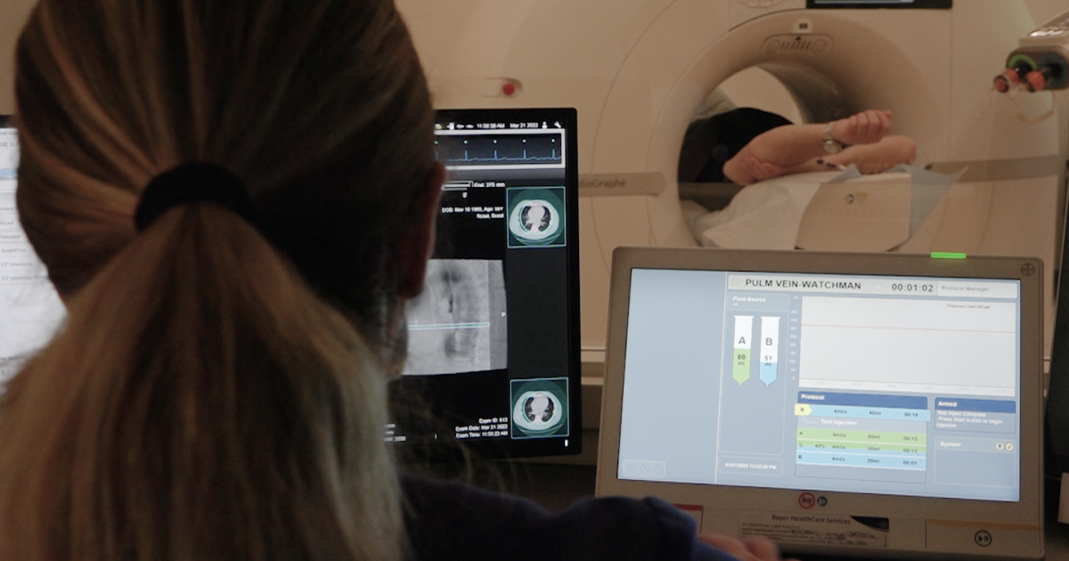 CCTA a helpful tool for interventional cardiologists planning coronary ...