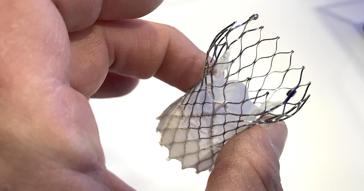 VIDEO: TAVR durability outperforms surgical valves