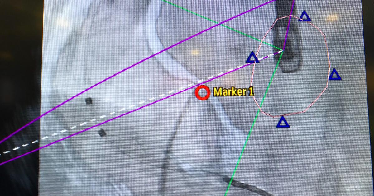 New ASE guideline outlines training standards for interventional ...