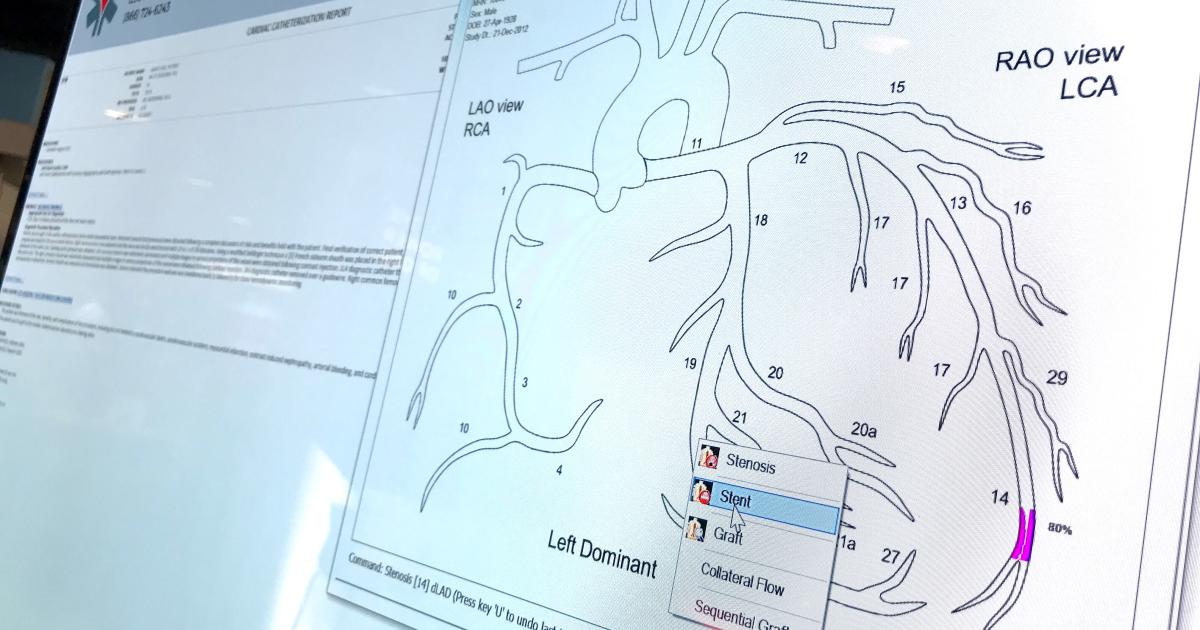 CVIS: Improving Departments from Within