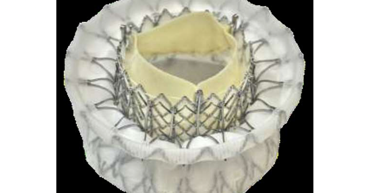 Cardiologist praises updated design of new TMVR system after historic ...