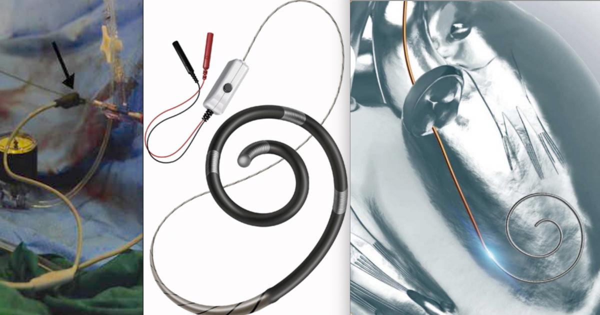 VIDEO: Use of temporary left ventricular pacing during TAVR procedures