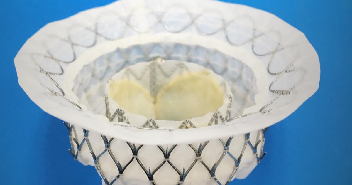 Intrepid transcatheter mitral valve pilot study shows positive 3-year ...