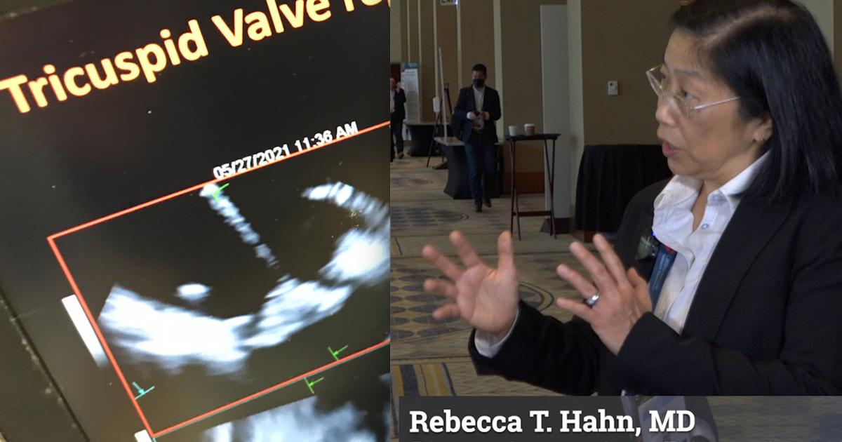 VIDEO: Trends in structural heart procedural imaging - a discussion ...