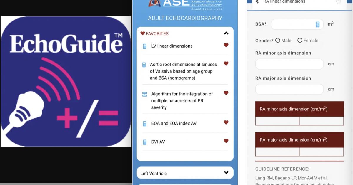 American Society of Echocardiography releases new EchoGuide clinical ...