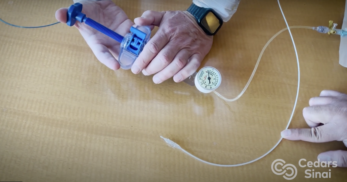 Cardiologists explore the real-world potential of new adjustable stents ...