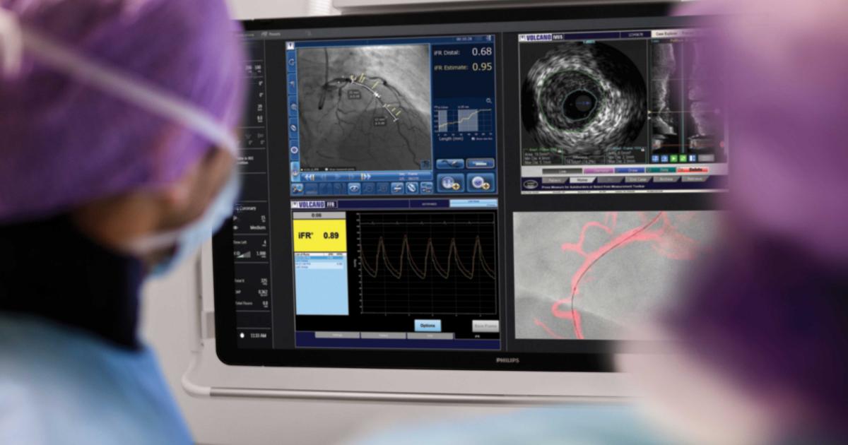 Intravascular imaging during PCI: Should cardiologists choose IVUS or OCT?
