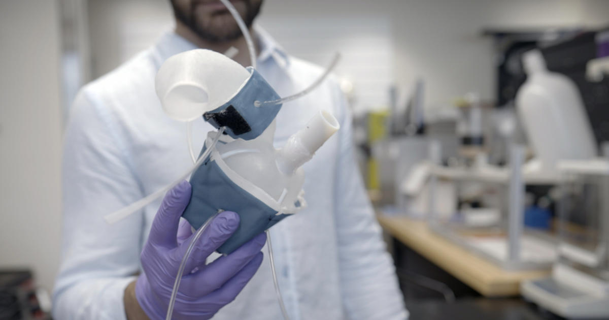 New patient-specific heart models could change how cardiologists make ...