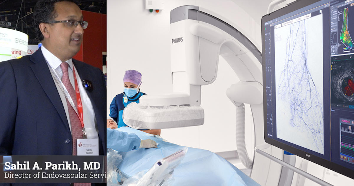 What do interventional cardiologists need to treat PAD and CLI?