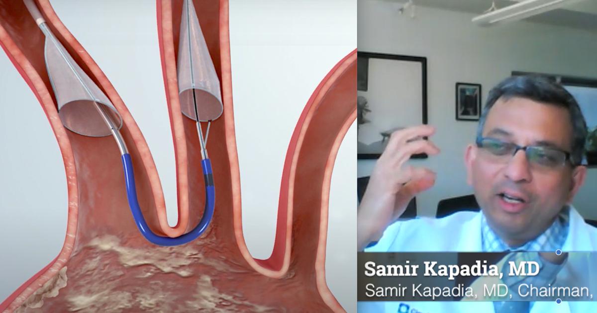 VIDEO: Exploring the use of cerebral protection devices during TAVR