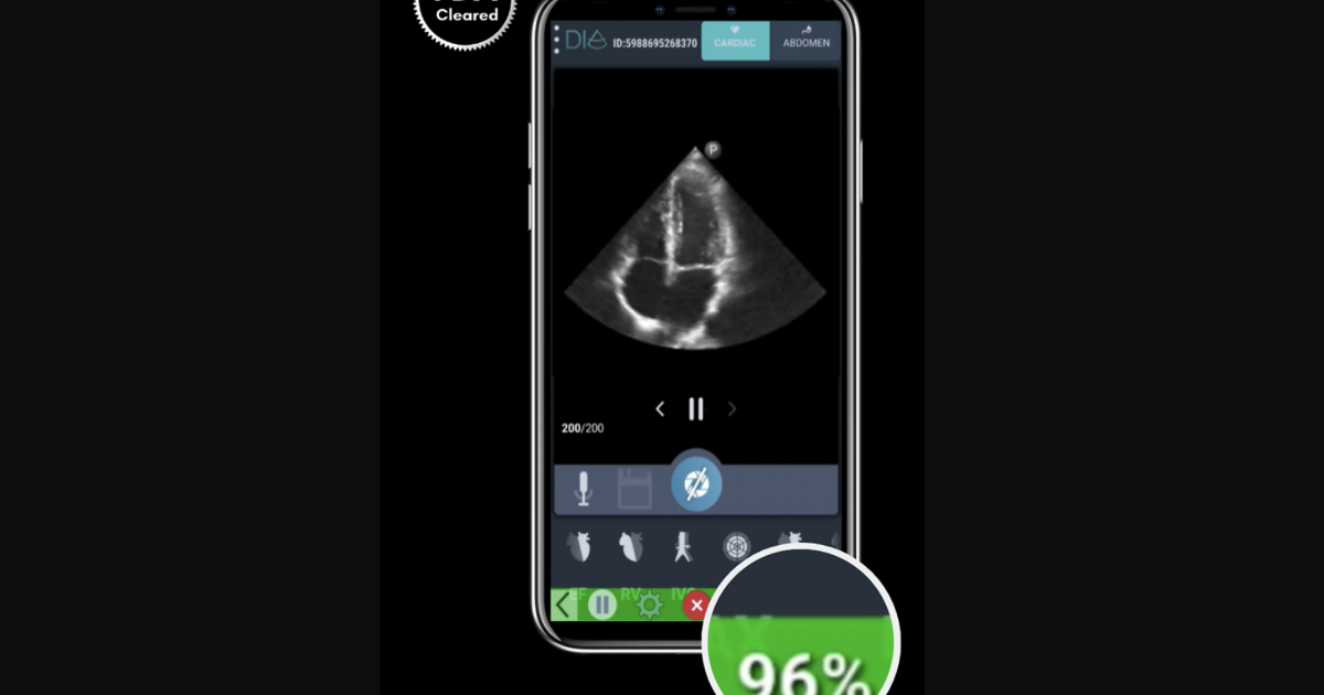 FDA clears new AI-powered cardiac imaging solution