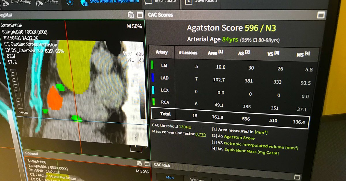 Cardiology still No. 2 in FDA-cleared clinical AI algorithms, trailing ...