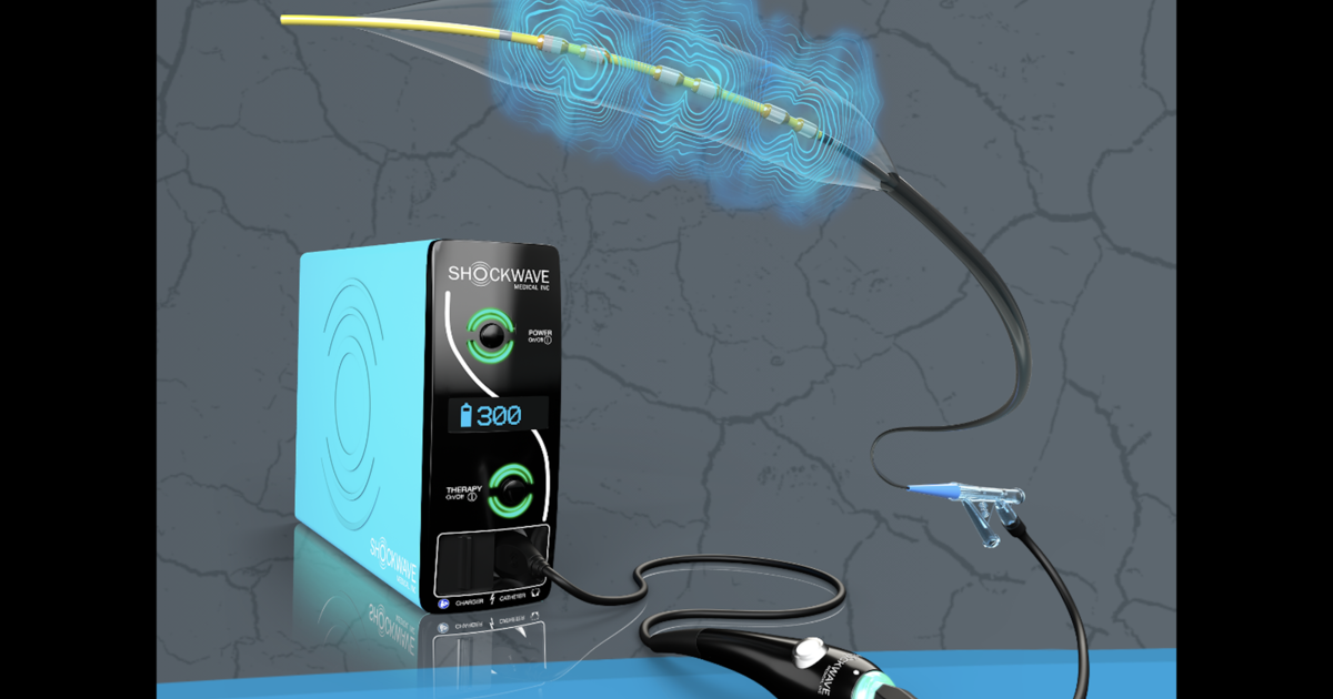 Shockwave Medical launches new IVL catheter for challenging lesions in US