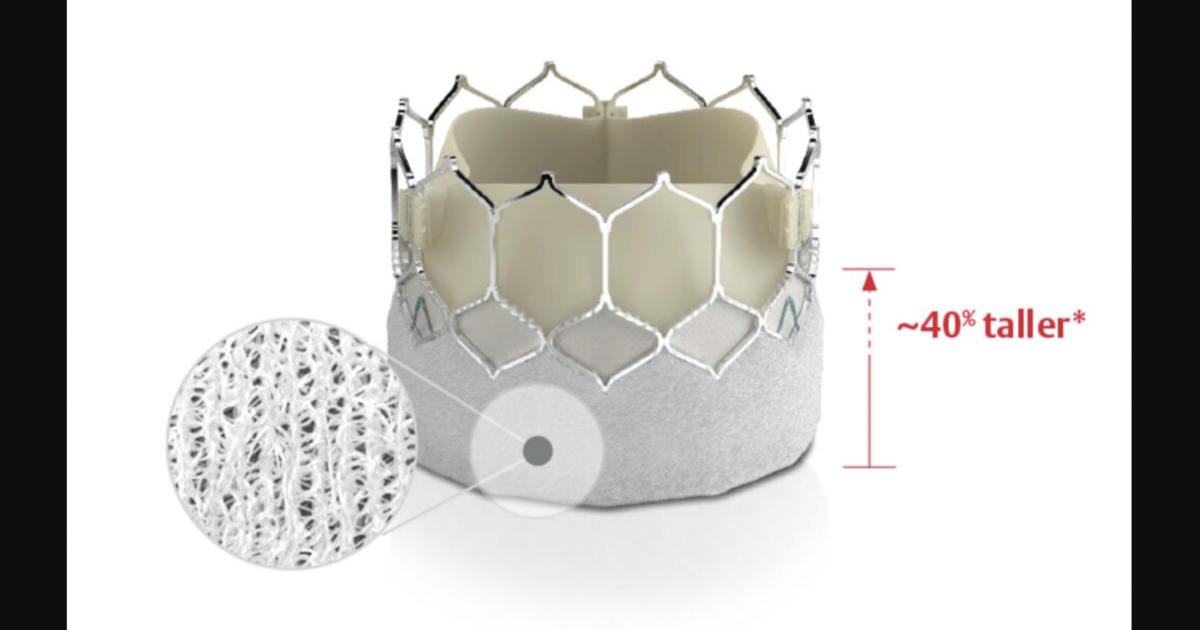 TAVR outperforms SAVR when treating women, historic all-female trial ...