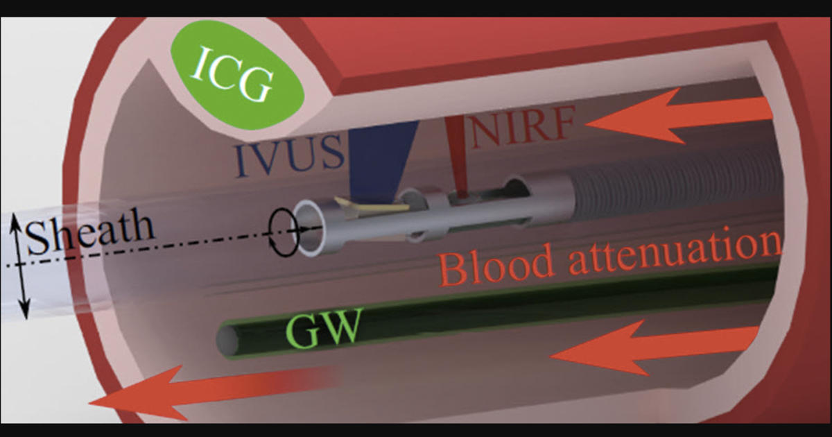 New technique improves accuracy of near-infrared fluorescence imaging