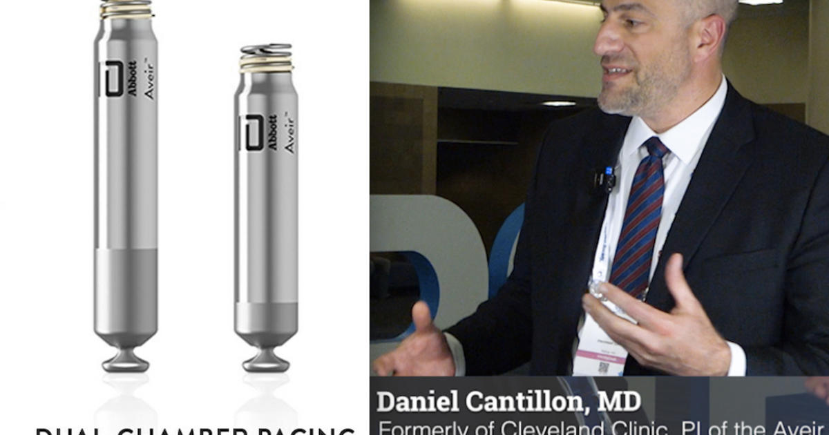 Early success of dual-chamber leadless pacemaker suggests big changes ...