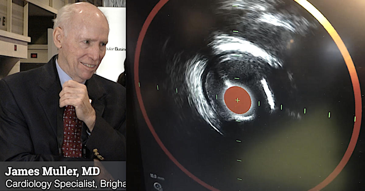 Nobel Prize-winning cardiologist on his quest to find and treat ...