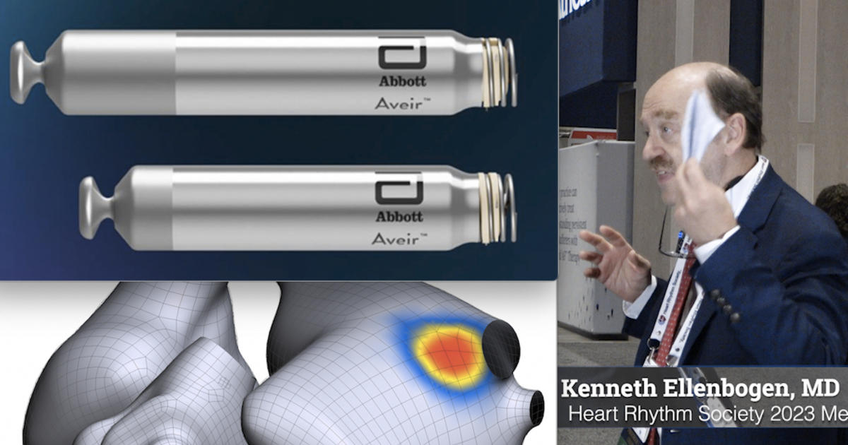 Key takeaways from Heart Rhythm 2023