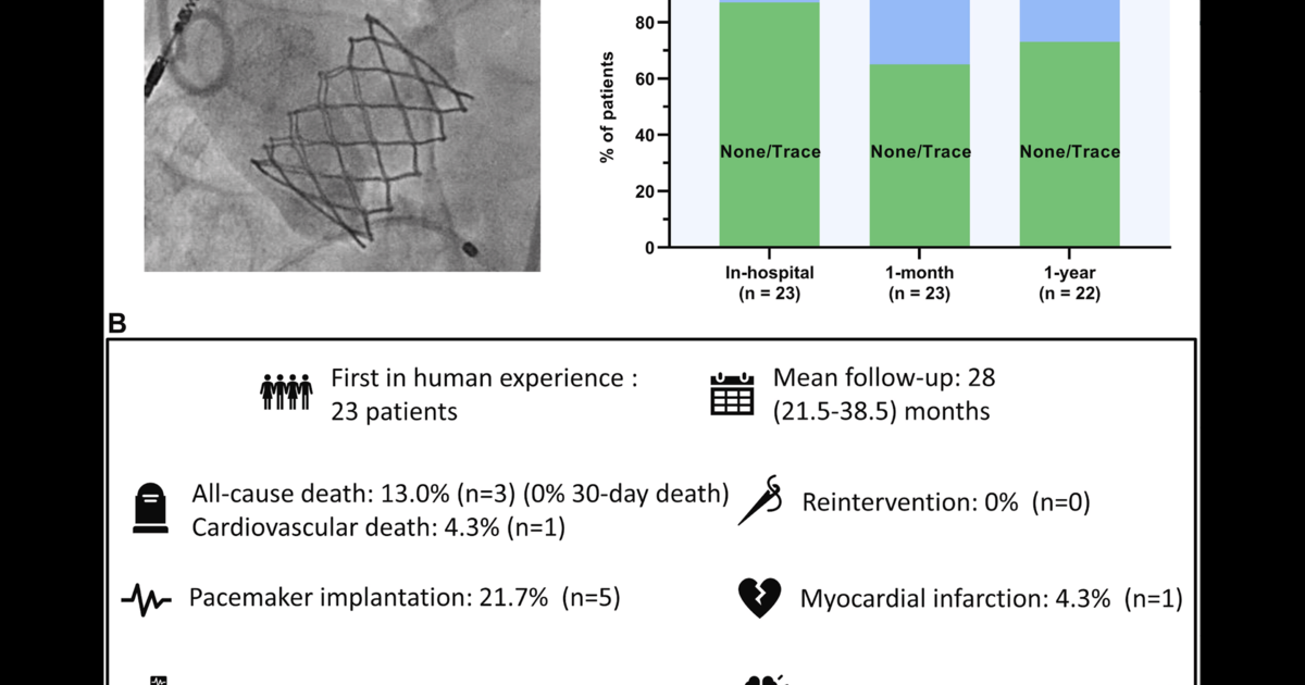 Next-gen TAVR valve, tested on patients for very first time, linked to ...