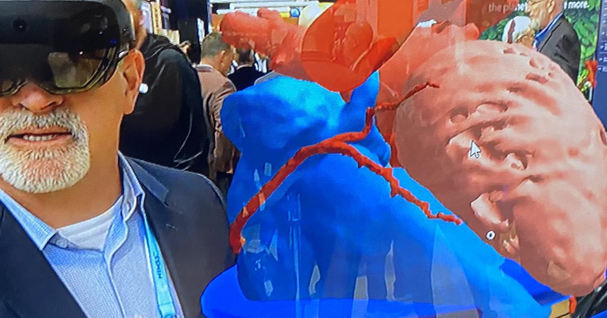 PHOTO GALLERY: Cardiac technologies on display at HIMSS 2023