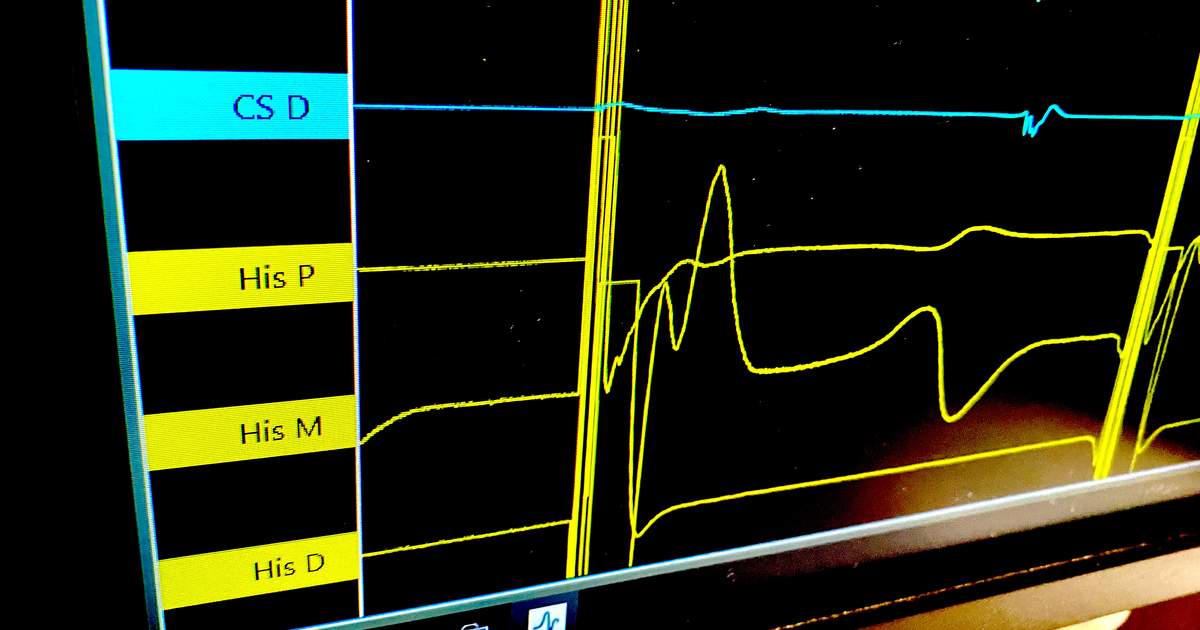 FDA clears 2 new AI models that help with the diagnosis and treatment ...