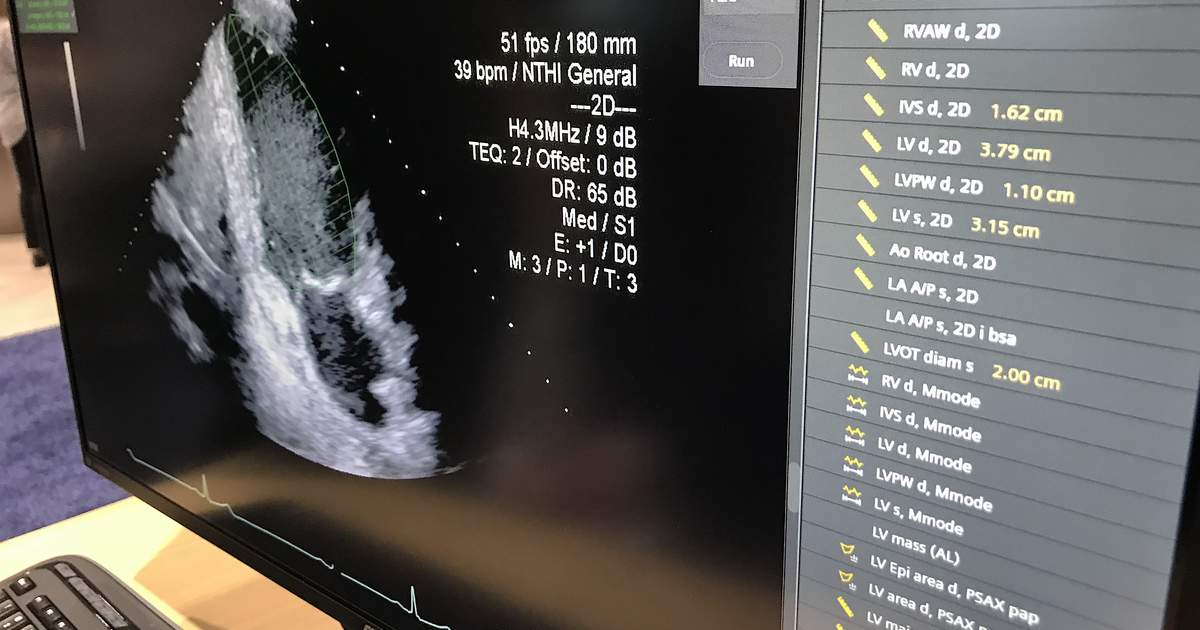 AI technologies to be featured heavily at ASE 2023