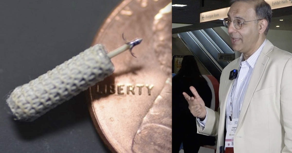 VIDEO: Jagmeet Singh details the SOLVE-CRT study for a leadless CRT system