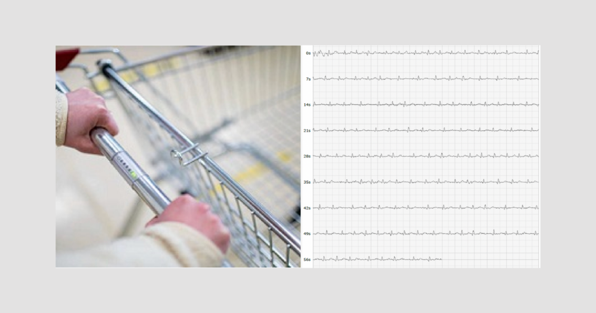Cardiology at the supermarket: Shopping carts upgraded to detect signs ...