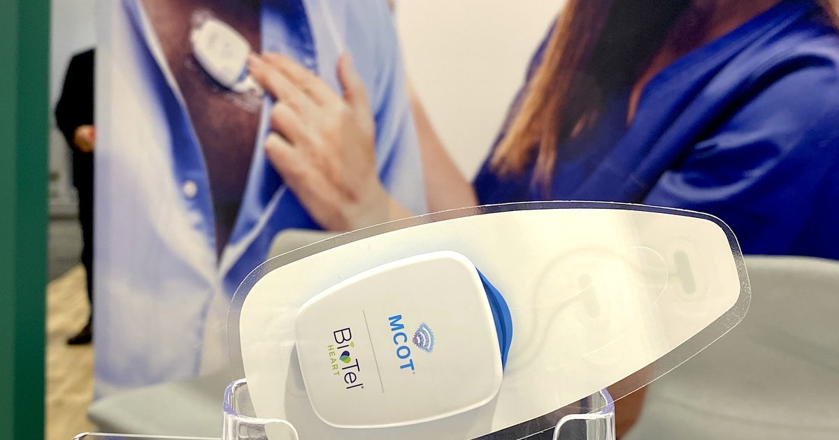 How long do wearable cardiac monitors record data?