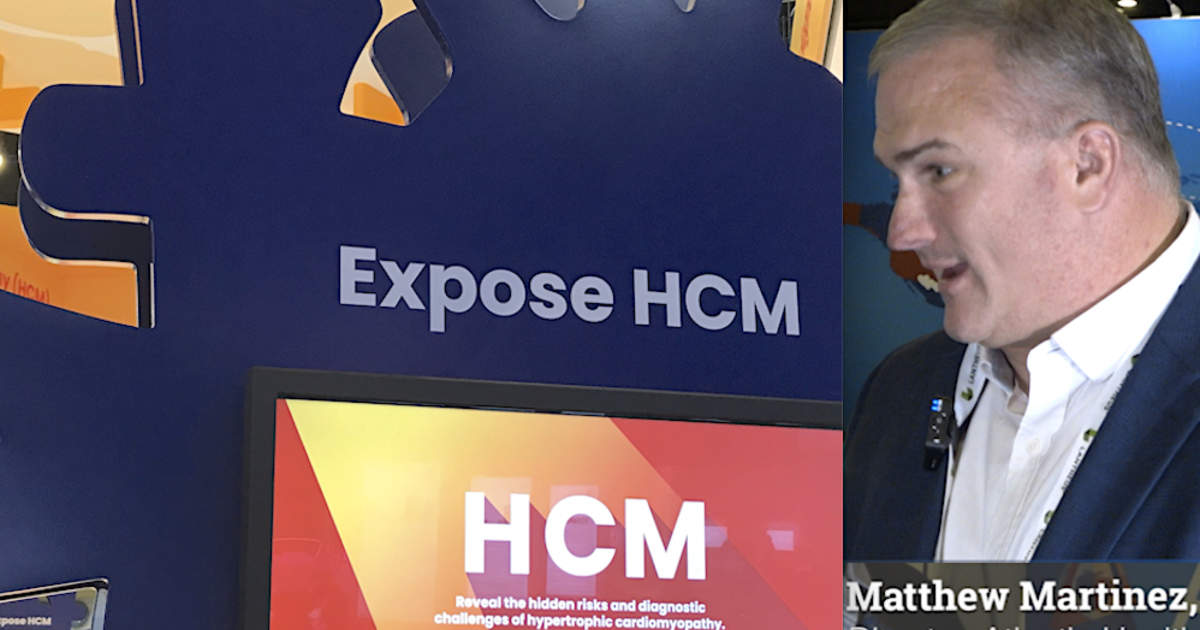 Exercise plays a key part in HCM management