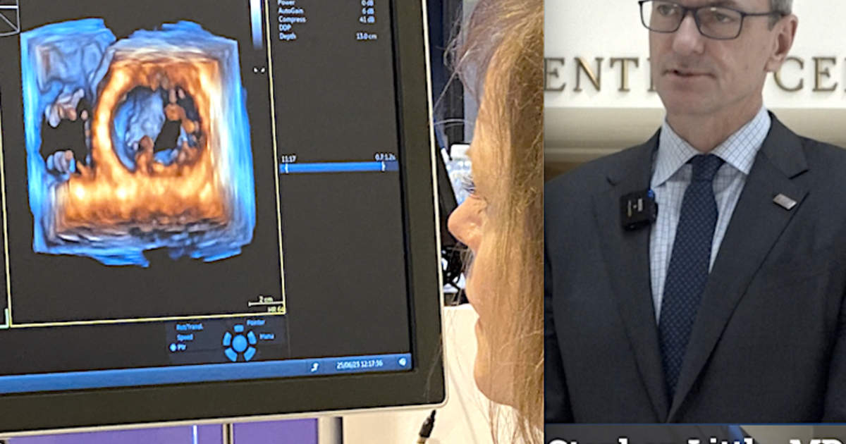 Back in the spotlight: Exploring echocardiography's revival