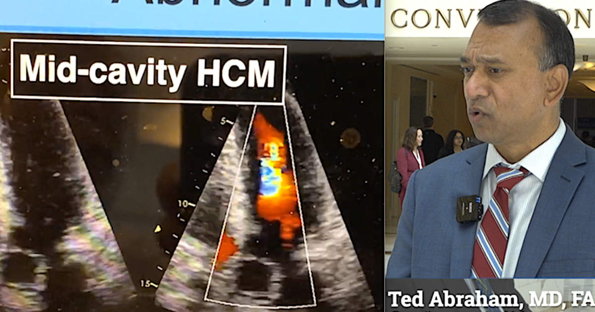 All eyes are on hypertrophic cardiomyopathy now that a drug treatment ...