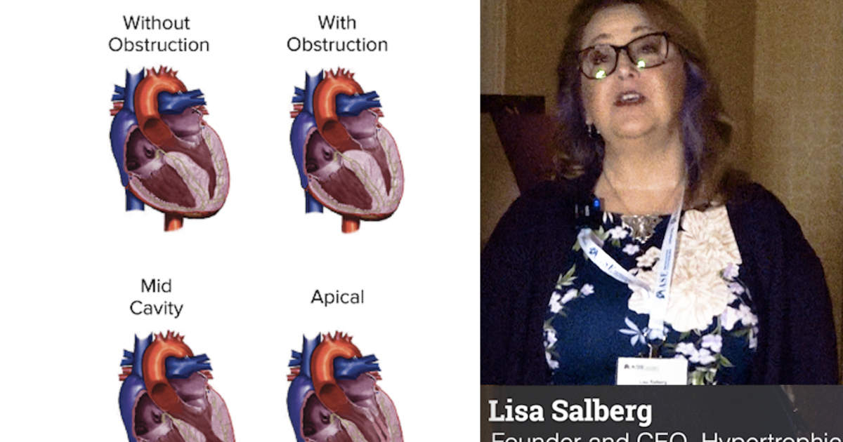 Hypertrophic Cardiomyopathy Association has helped advance HCM care