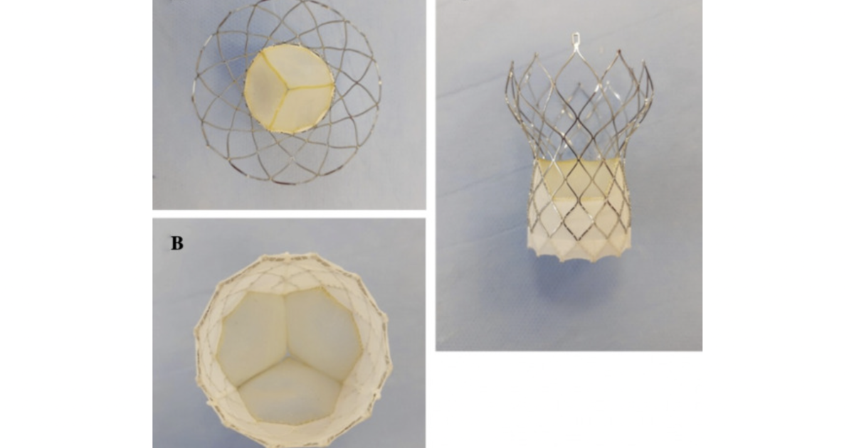 New TAVR valve, premounted to save cardiologists time, linked to ...