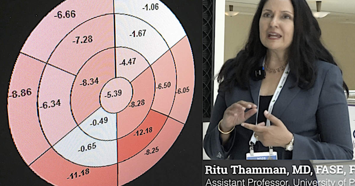 Strain imaging making a significant impact on the treatment of heart ...
