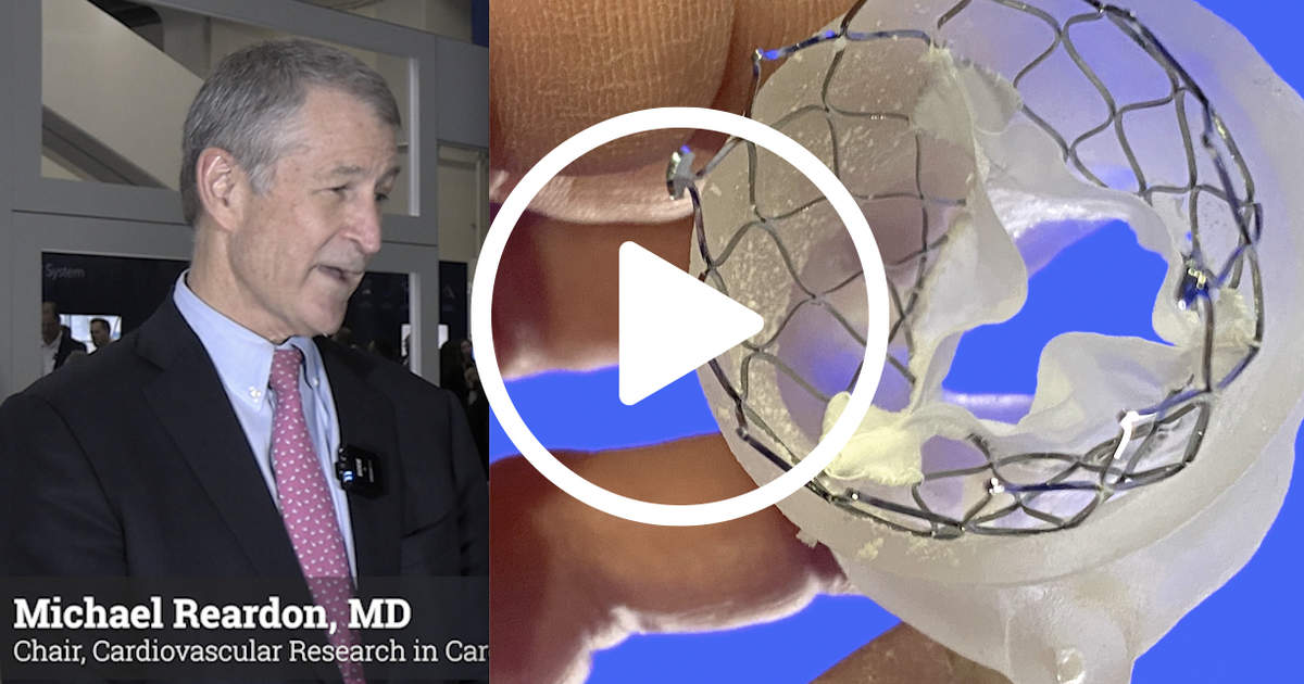 TAVR triumphs over surgery: Exploring 4-year data from the Evolut Low ...