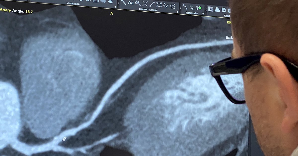 SCCT aims to provide common language for CCTA use with updated guidance