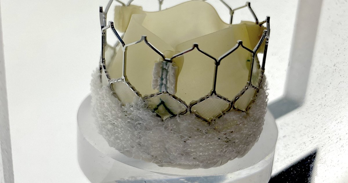 Newest TAVR valve from Edwards Lifesciences improves survival, real ...