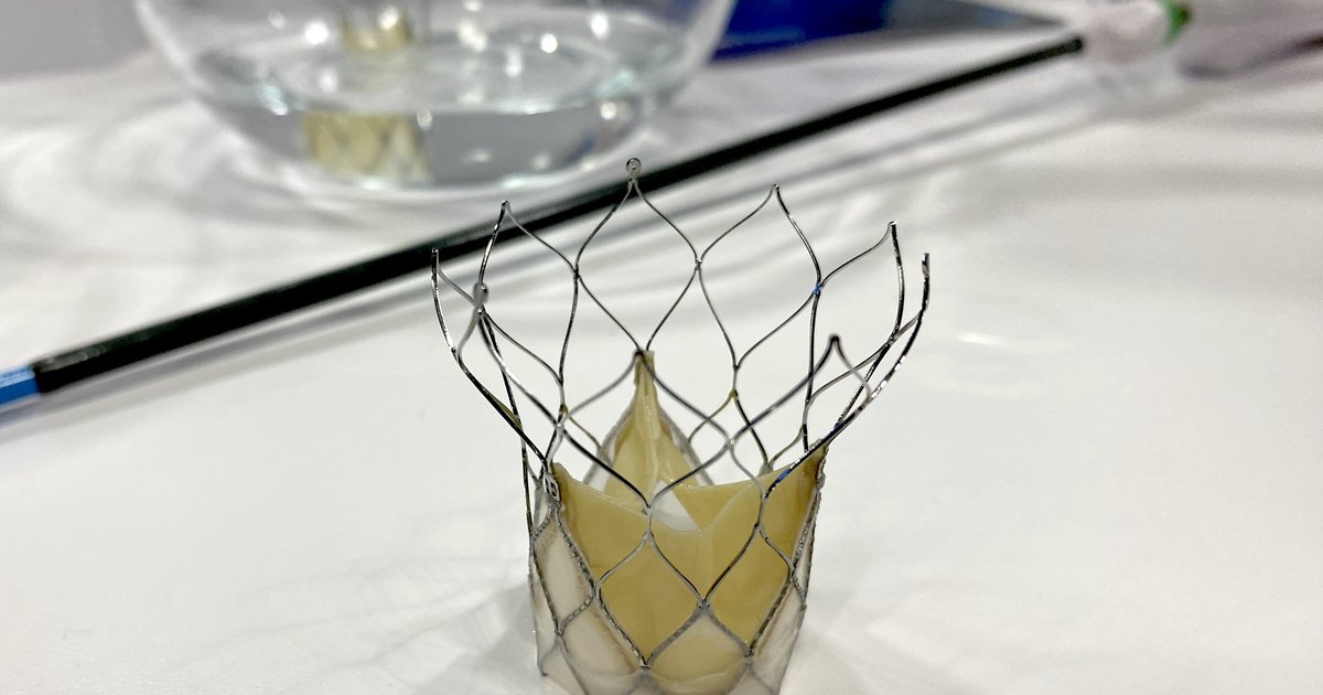 Abbott’s Navitor TAVR valve linked to positive real-world outcomes